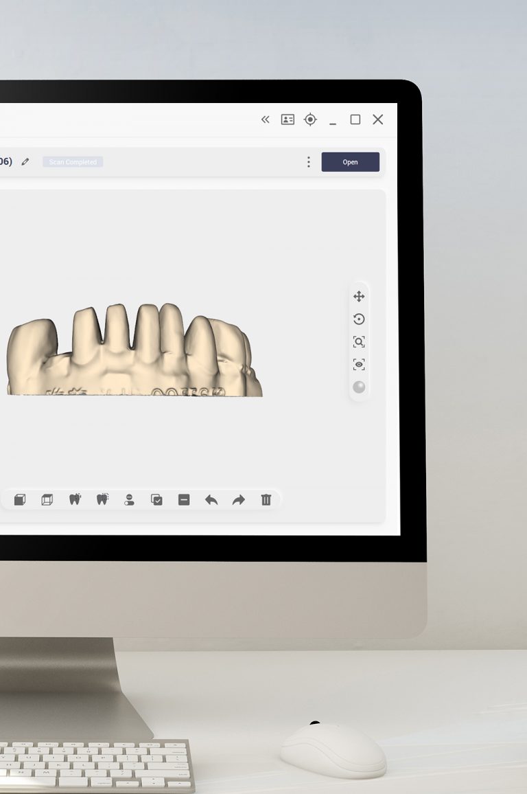 Elementor #1481 - Intra Oral Scanner, Milling Machine, Zirconia Blocks | CEDU TECH